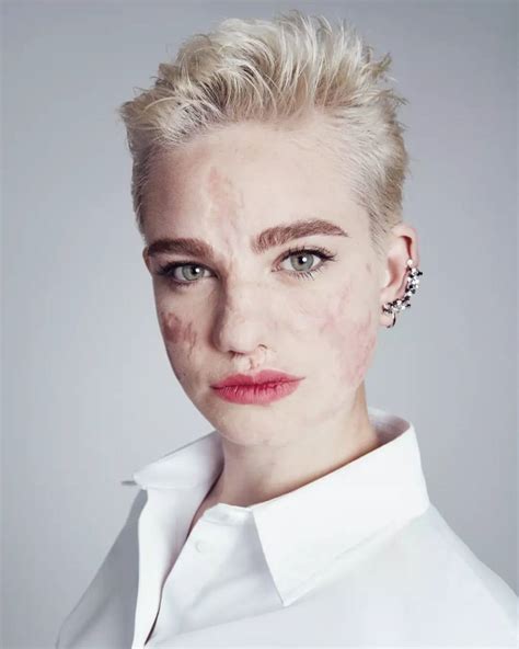 Juara Paralimpik Beatrice Vio Menjadi Wajah Baharu Loréal Tampilkan