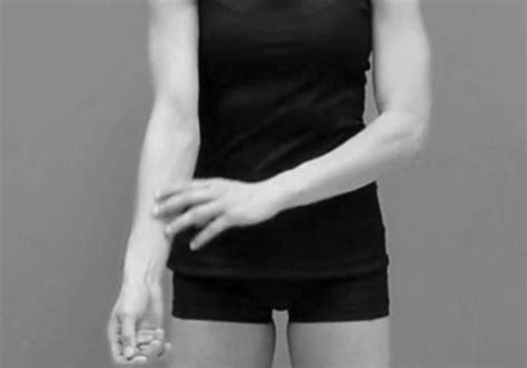 Radial Triggerband Fascial Distortion Model®