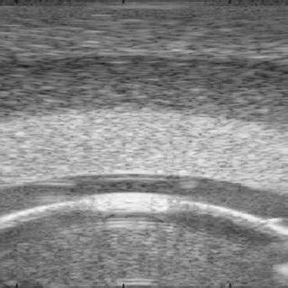 PDF Analysis Of Existing Designs For FPGA Based Ultrasound Imaging Systems