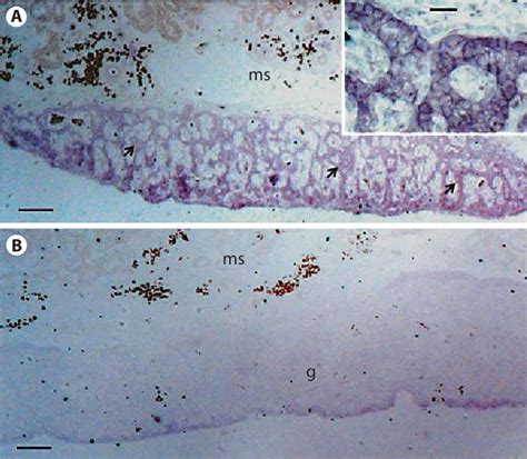 Figure 6 From Gonadal Morphogenesis And Gene Expression In Reptiles With Temperature Dependent