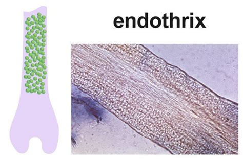 Endothrix En Ectothrix Groeiwijzen Van Schimmels In Haren