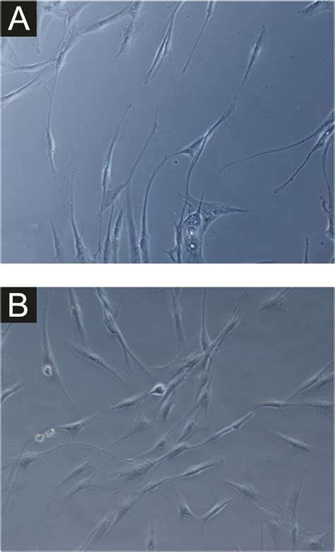 Phase Contrast Microscopy Showing Fibroblasts From Skin With Facial Download Scientific Diagram