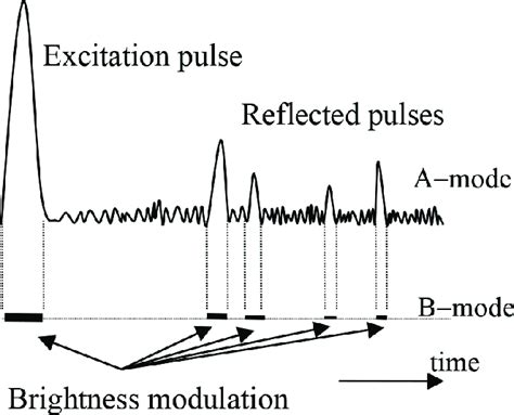 Comparison Of A Mode And B Mode Of Imaging Download Scientific Diagram