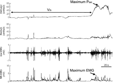 Figure 1 From Multiple Pudendal Sensory Pathways Reflexly Modulate