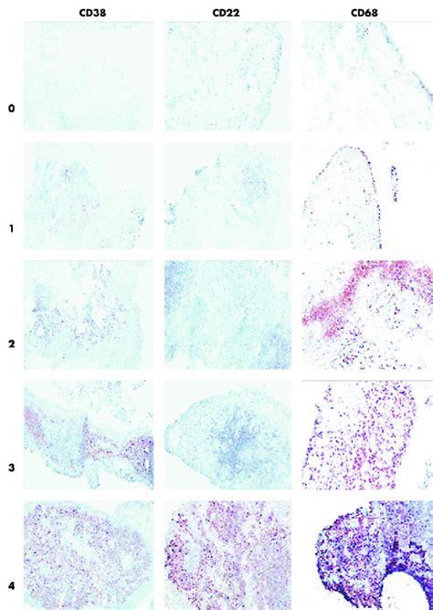 Semiquantitative Scoring Of Synovial Tissue Download Scientific Diagram