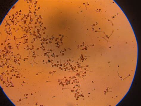 A Cellprofiler Pipeline Designed To Accurately Quantify Total Pollen
