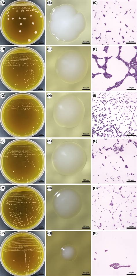 Streptococcus Pyogenes Colony Morphology