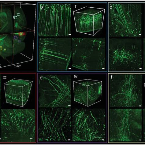 High‐throughput Whole‐brain Imaging At Isotropic Cellular Resolution Download Scientific