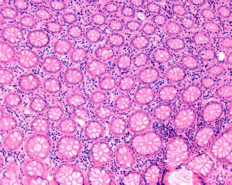 20 Kripta Lieberkuhn Foto Foto Stok Potret And Gambar Bebas Royalti Istock