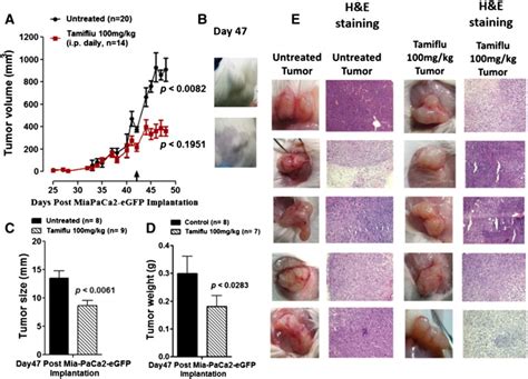 Tamiflu Treatment At 100mgkg Ip Impedes Human Pancreatic