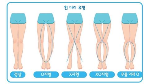 다리 예뻐지는법 공유 하자 네이트 판