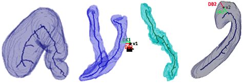 A Segmentation Of Multiple Organs And Their Skeleton Shown By Dark Download Scientific Diagram