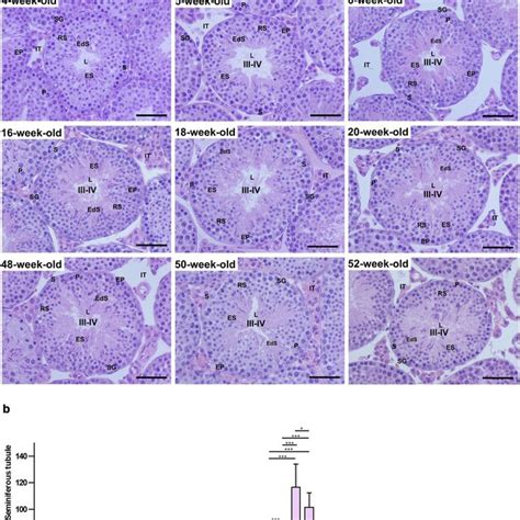 A Representative Micrographs Of The Postnatal Mouse Testes From 1 To