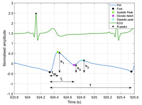graphical example of pw fiducial points and morphological parameters