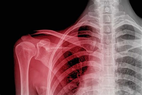 37 Facts About Dislocation