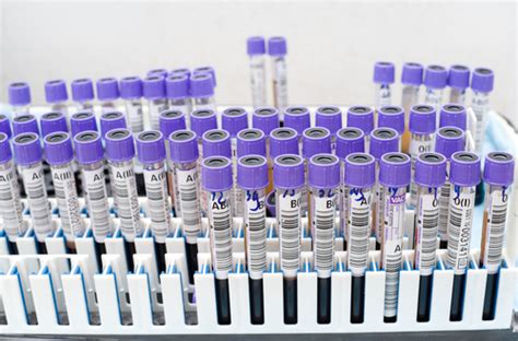 The Surgery Lyminge About Medical Tests And How To Get Your Results