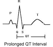 Electrolytes ECG Changes Foods Flashcards Quizlet