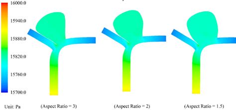 A Maximum Flow Velocity Inside The Aneurysm Pre Operation B