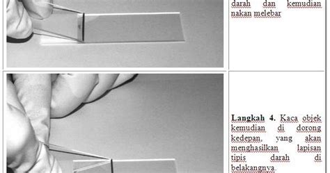 Sediaan Apus Darah Tepi Sadt For You From Me