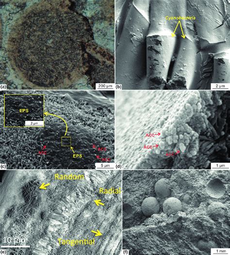 A Photomicrograph Showing Girvanella In The Cortex And Core Of