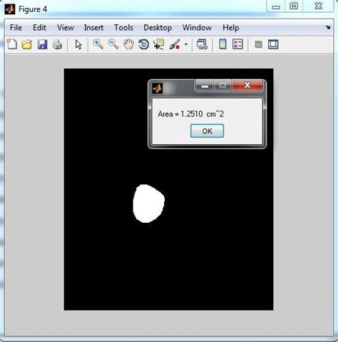 Extracted Area Calculation For Brain Tumor Download Scientific Diagram