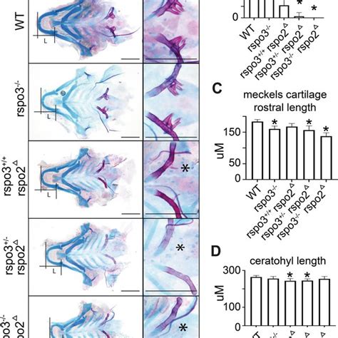Rnascope Gene Expression Analysis Of Rspo2 And Rspo3 In Mouse Embryos Download Scientific