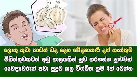 වේදනාකාරී දත් කැක්කුම පටස් ගාලා හොද කරගන්න මෙන්න මේ ස්වභාවික ප්‍රතිකාර ගැන දැන්ම දැනගන්න Youtube