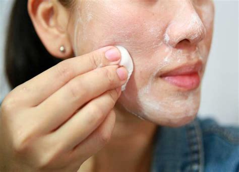 درمان کک و مک در 3 سوت با عکس کوروک