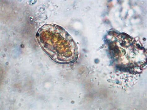 Egg Of Ancylostoma Duodenal40x Download Scientific Diagram