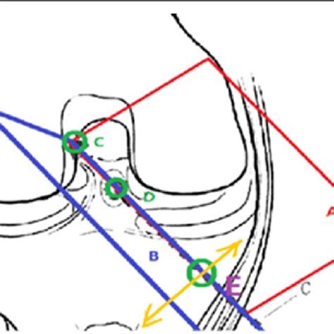 The Measurement Of The Tibia A Transverse Diameter B Download Scientific Diagram