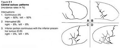 Central Sulcus Definition Location Mri And Function