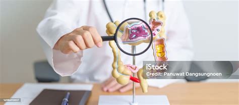 인간 결장 해부학 모델과 돋보기를 가진 의사 대장 질환 대장 대장암 궤양성 대장염 게실염 과민성 대장 증후군 및 소화기 계통 대장암에 대한 스톡 사진 및 기타 이미지