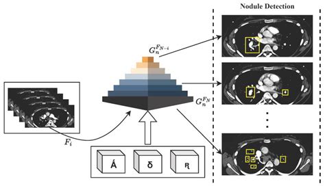 Diagnostics Free Full Text Early Detection Of Lung Nodules Using A Revolutionized Deep