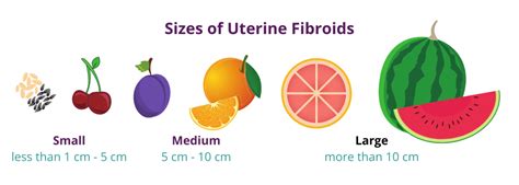 A Visual Guide To Fibroid Sizes Usa Fibroid Centers