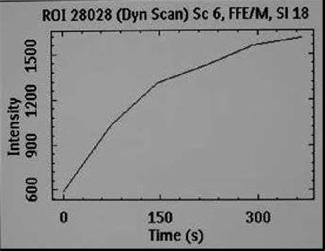 Time Signal Intensity Curve Type 1 Download Scientific Diagram