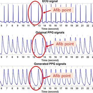 A Input ECG Example B Generated PPG And Original PPG Examples Download Scientific Diagram