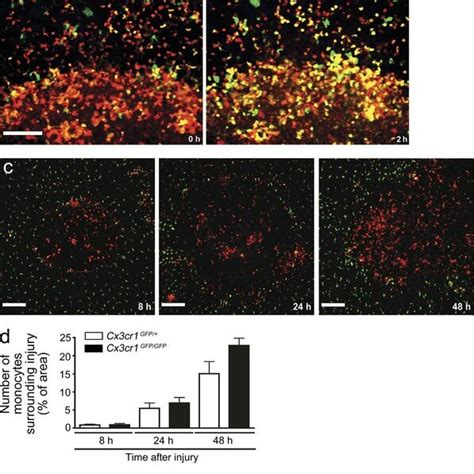 Ccr2⁺ Monocytes Transition Into Ccr2⁺cx3cr1⁺ Monocytes At A Site Of