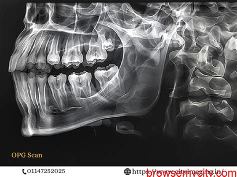 Opg X Ray Cost Pricing Factors And Affordable Options01147252025 368272