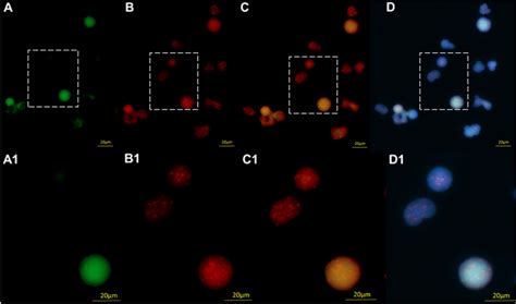 The Cml Cd34 Positive Cells Fluoresce Green Whereas The Other