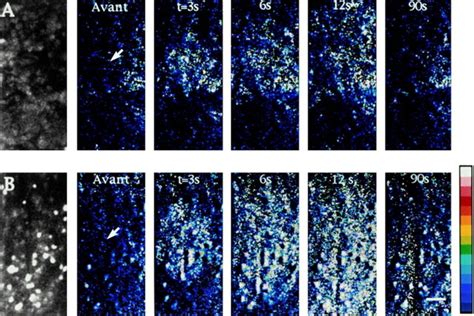 Effect Of Neurons On The Extent Of Calcium Wave Propagation In Download Scientific Diagram