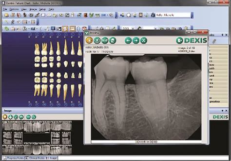 Dentrix Ascend Emr Software Free Demo Pricing Latest Reviews 2026