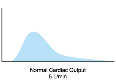 Hemodynamic Monitoring Values Flashcards Quizlet