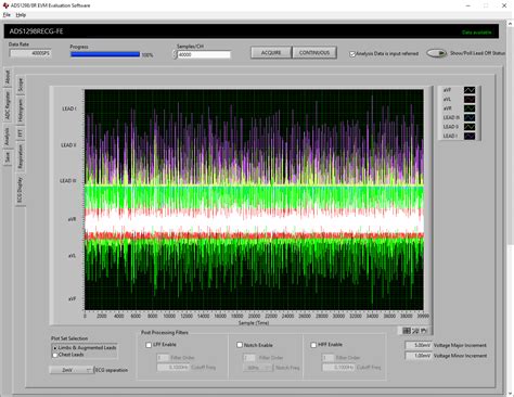 Ads1298ecgfe Pdk Measured Signals Are Not Similar To Ecg Signals Data Converters Forum Data