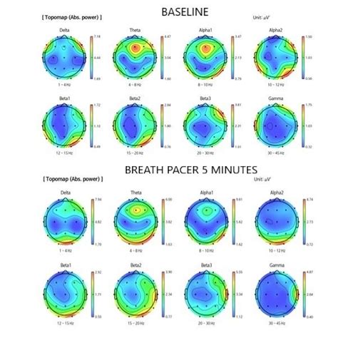 This Image Shows Eeg Brain Topography Topomap Data Comparing