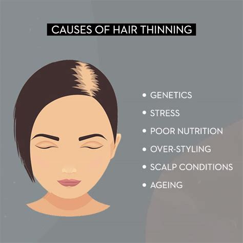 Hair Loss Khd Hair Loss Clinic