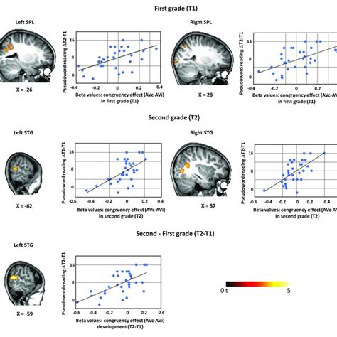Statistics Of Whole Brain Fmri Analyses Download Scientific Diagram