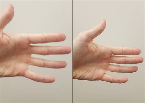 Chapter Motion Correction Andy S Brain Book Documentation