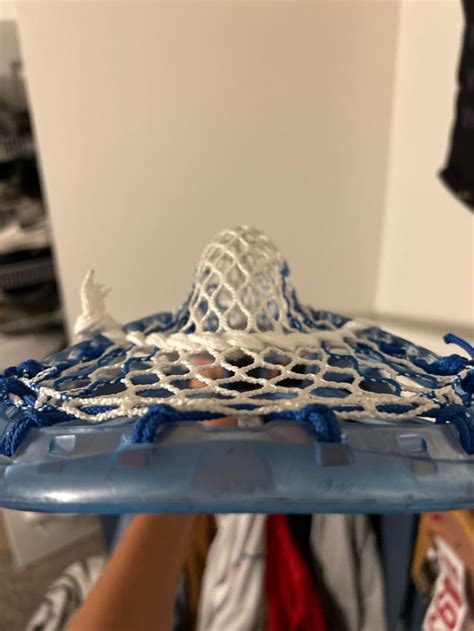 Ion String To The Inside Doesnt Seem Legal Rstickdoctor