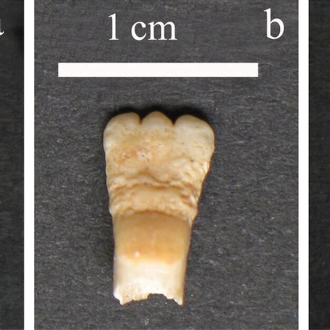 Sem Images Right Maxillary Central Incisor Buccal View 39 × A Download Scientific