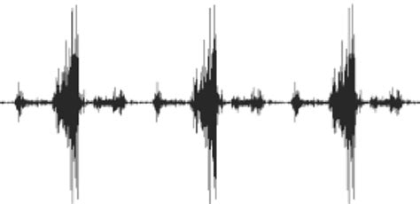 Typical Emg Pattern Download Scientific Diagram